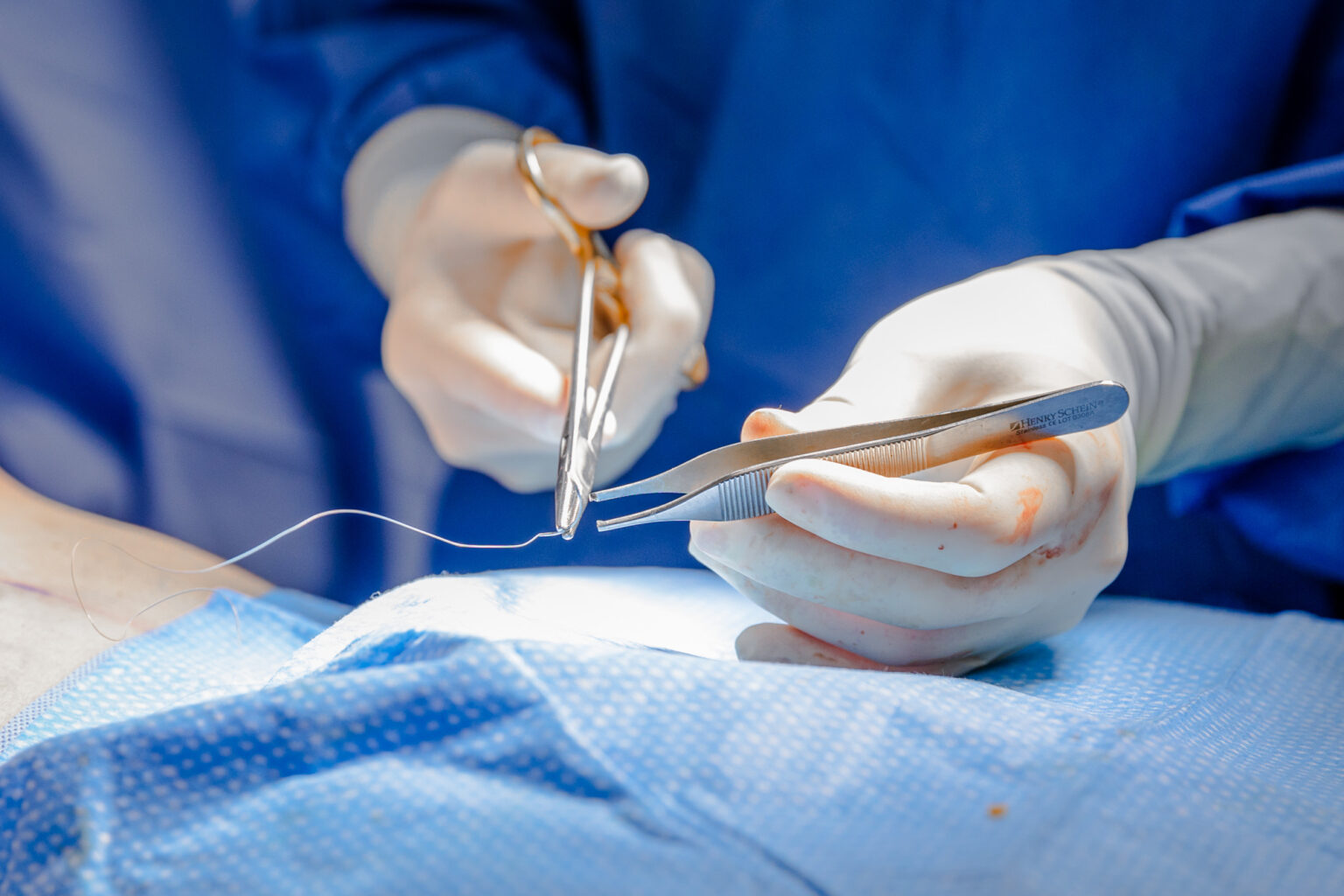 Breast Lift in Oklahoma City | Cosmetic Surgery Affiliates